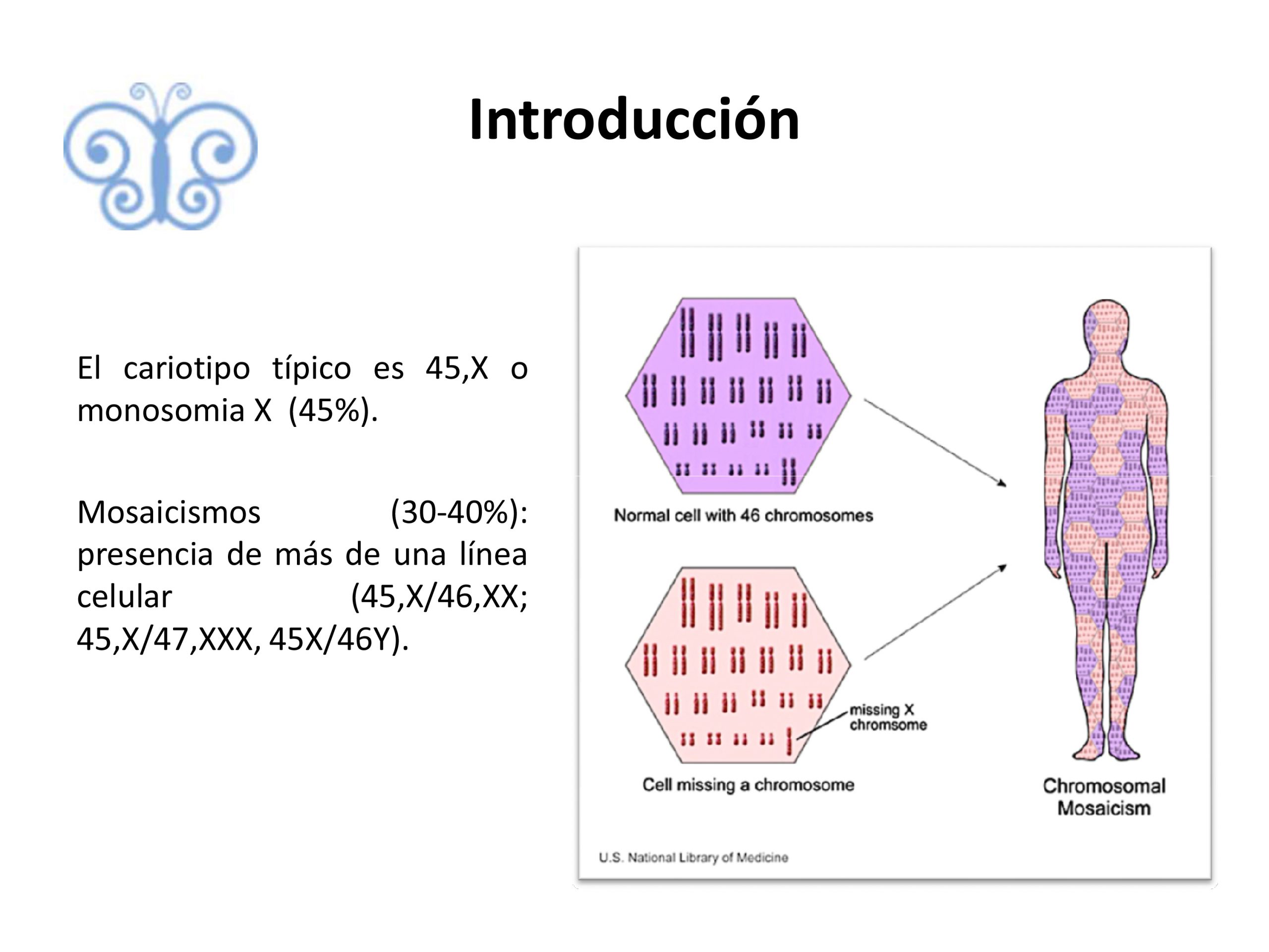 El síndrome de turner – FEDERACIÓN ESPAÑOLA SINDROME DE TURNER